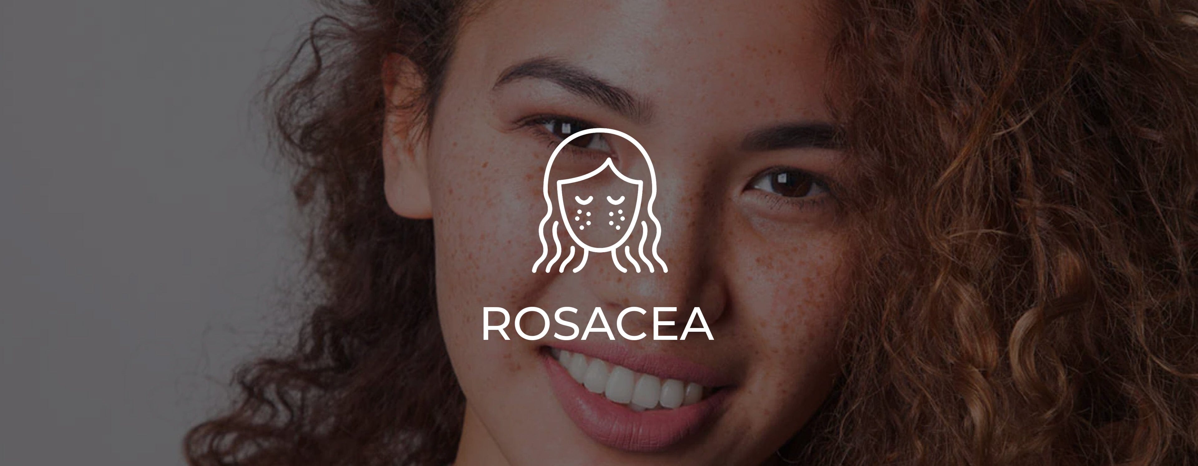Rosacea Prone Skin – Svens Island New Zealand